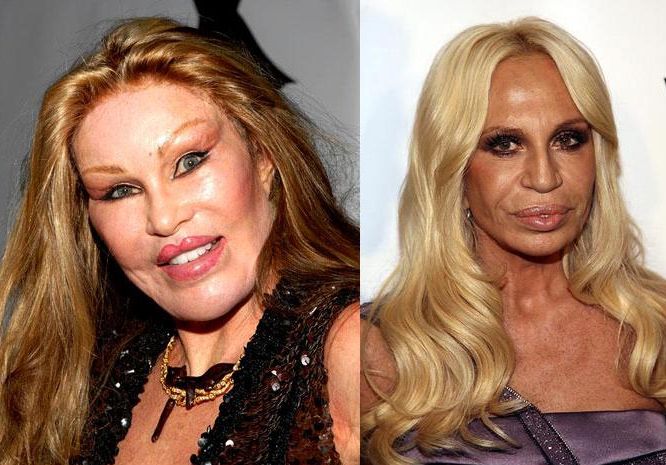 Donatella Versace Antes E Depois Donatella Versace's Face, Then And